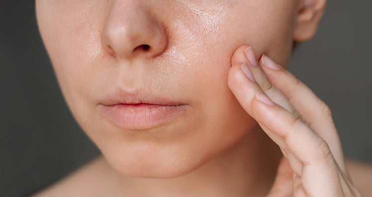 What’s Making Your Skin Shine? 8 Common Causes of Oily Skin